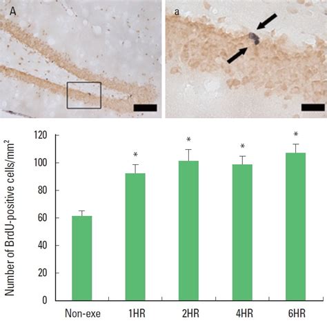 Duration Dependence Of The Effect Of One Bout Treadmill Exercise On Download Scientific Diagram