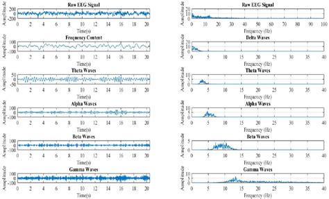 Figure 1 From Real Time Eeg Based Automatic Brainwave Regulation By