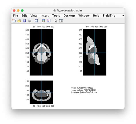 Channel And Source Analysis Of Mouse EEG FieldTrip Toolbox