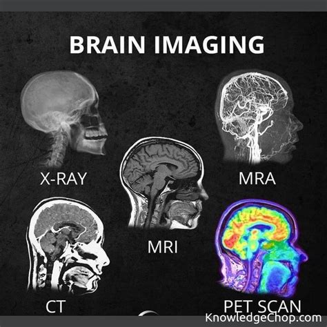 The Difference Between Scans Knowledge Ninja