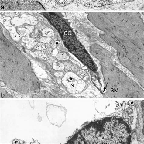 Icc Associated With The Myenteric Plexus And The Longitudinal Muscle