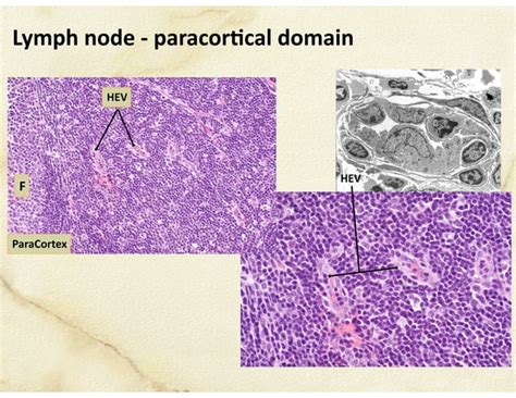 Lymphoid Organs Trafficking Lymphoma 2021pdf
