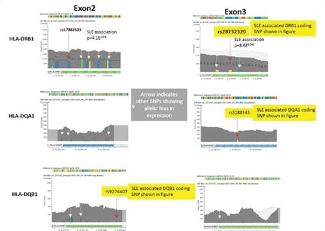 Schematic View Of Exon Hla Drb1 Hla Dqa1 Hla Dqb1 Polymorphisms In