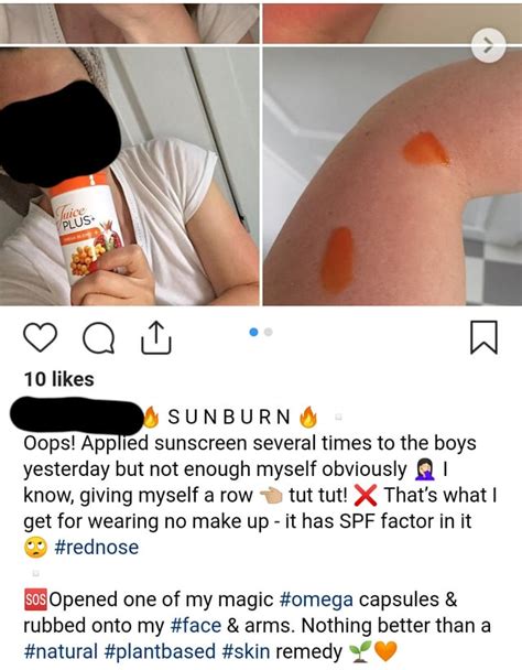 Juice Plus Sunburn Treatment Rantimlm