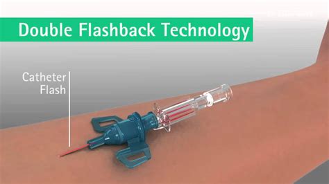 Introcan Safety Catéter Intravenoso Con Sistema De Seguridad Youtube Introcan Safety Catéter Intravenoso Con Sistema De Seguridad Youtube