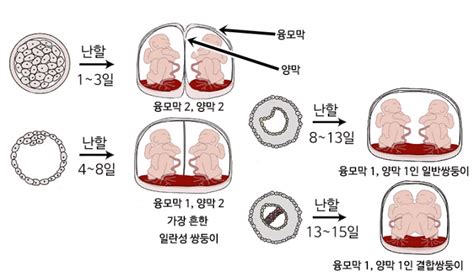 사람들이 잘 몰랐던 샴쌍둥이 탄생 과정과 ‘몸 주도권