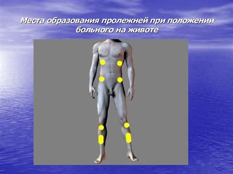 Пролежни (профилактика, лечение) - презентация онлайн