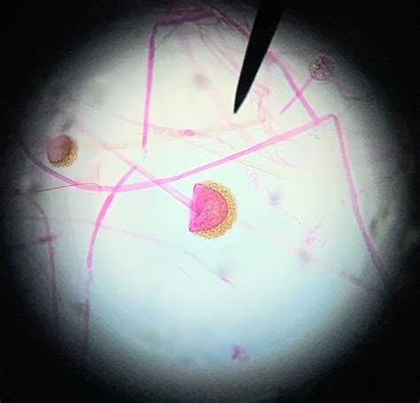 Gen Bio II Fungi Lab Flashcards Quizlet