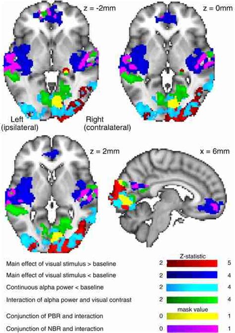 Mixed Effects Group Z Statistic Maps All Cluster Corrected Z20 P Download Scientific Diagram