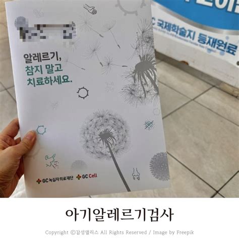 아기 유아 비염 아기 알레르기 알러지 검사 아기꽃가루알레르기 Mast검사 네이버 블로그