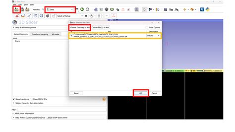 Github Sperrine3dslicersegmentationtutorial