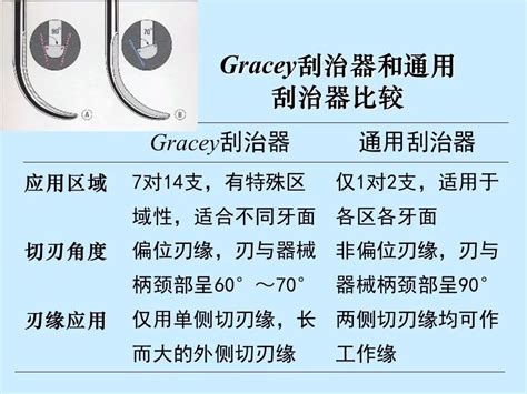 不得不知的治疗牙周炎的5种最有效方法！ 好医术文章 好医术 赋能医生守护生命