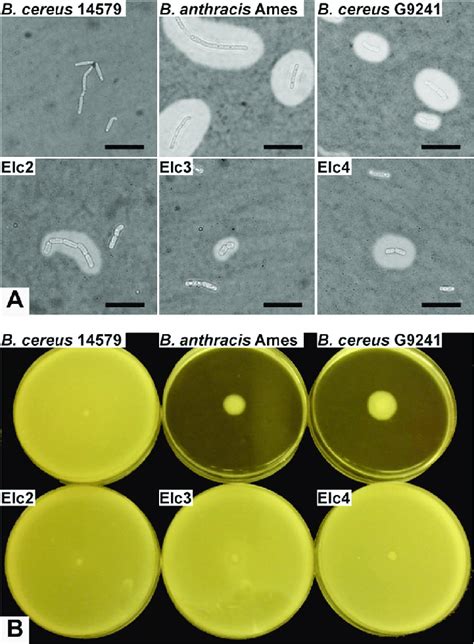 Phenotypic Characterization Of Bacillus Cereus Strains Recovered From Download Scientific