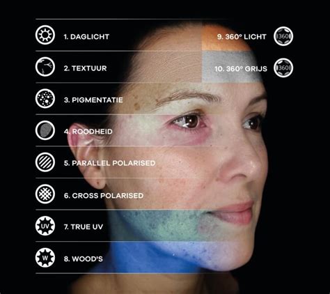 Skin Analysis — The Hestia Clinic