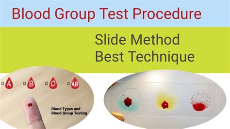 Types Of Blood Group Testing Machine At Ronda James Blog
