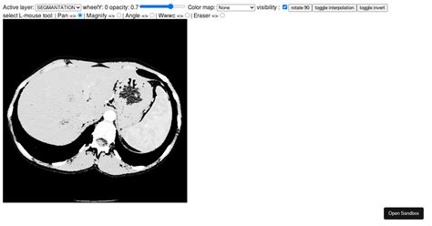 Cornerstone React Example Forked Codesandbox