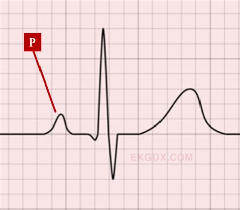 Ekgdx The New Era Of Ekg Learning