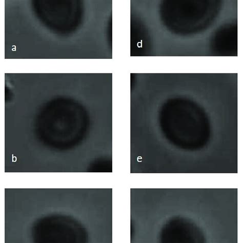 Intact Saccharomyces Cerevisiae Cells A C Compared With Download Scientific Diagram