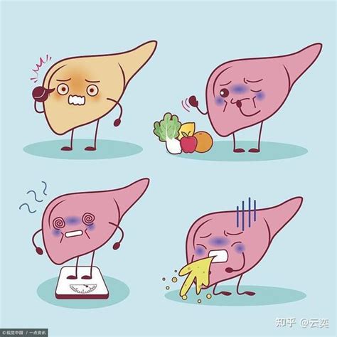 肝病科刘慧敏主任介绍：晚期肝硬化的并发症 知乎