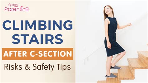 Climbing Stairs After C Section Risks And Safety Tips Youtube