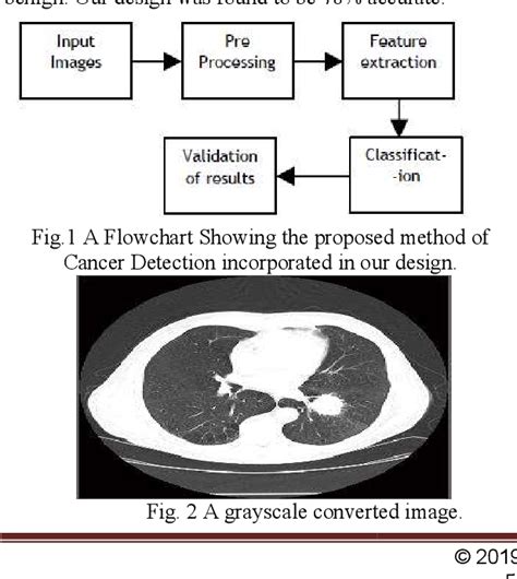 Figure 2 From Lung Cancer Detection Using Digital Image Processing And Artificial Neural