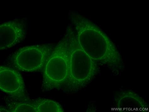 Rangap1 Antibody 67146 1 Ig Proteintech