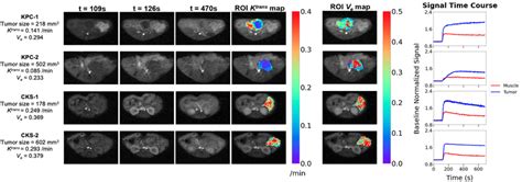 Comparison Of Quantitative Dce Mri Features And Parametric Maps Between Download Scientific
