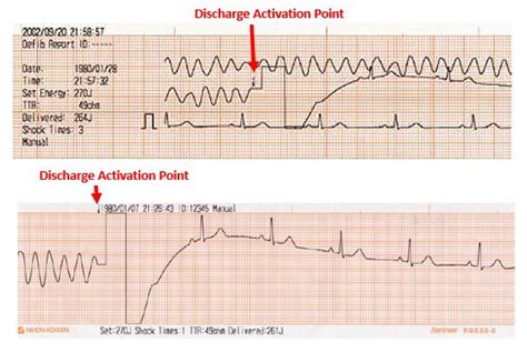 Medical Devices Sanity Nihon Kohden Cardiolife Acti Biphasic