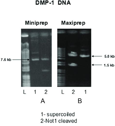 A Miniprep And B Maxiprep Is Shown On The 1 Agarose Gel Download Scientific Diagram