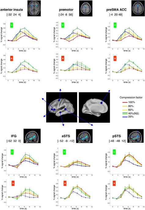 Time Course Of Fmri Responses In Regions Exhibiting A Nonlinear Profile