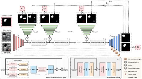 Multi Level Global Context Cross Consistency Model For Semi Supervised Ultrasound Image
