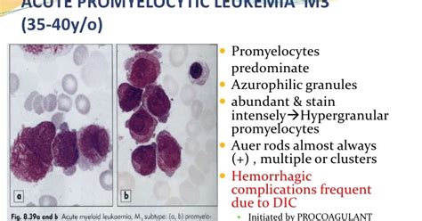 My World My Story 54 Hari Bersama Apml