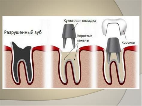 Частичная потеря зубов презентация онлайн
