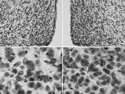 Building A Sex Specific Brain Science AAAS
