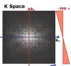 Physics MRI Spatial Encoding MRI Flashcards Cram Com