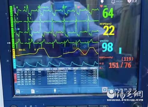 全国前列西电集团医院第一例Micra av无导线双腔起搏器成功植入