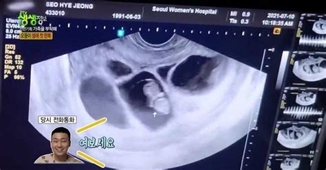 다섯 쌍둥이 임신한 군인 부부의 대화‥