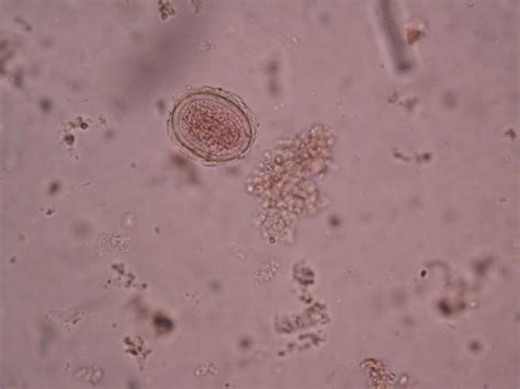 Nematodes Parasite Practical Lab Flashcards Quizlet