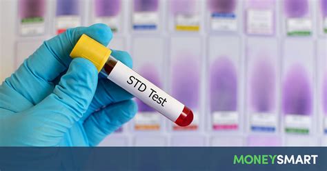 Suspect Std Symptoms Cost Of Std Tests And Clinics In Singapore