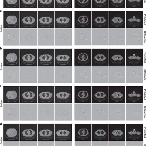 3d image reconstruction with ultra sparse projection view data a a