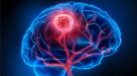 Tumor Removal Surgery Steps Risks And Postoperative Care Asia