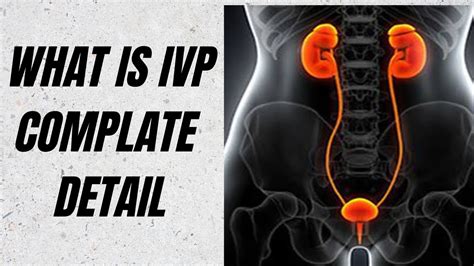 What Is Ivp Intravenous Pyelogram In Radiology A Complete Details Bsc Radiology Bxrt