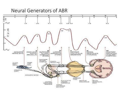 Auditory Brainstem Response Ghfghhfrh Pptx