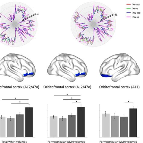 Between Group Comparison At The Node Level Using The Brainnetome Atlas Download Scientific