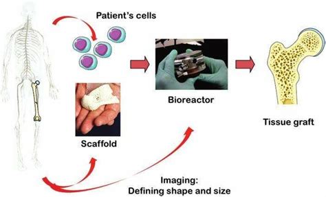 Bone Tissue Engineering Paradigm Download Scientific Diagram