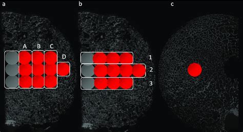 Voi Definition On Representative μct Cross Sectional Images Excised Download Scientific