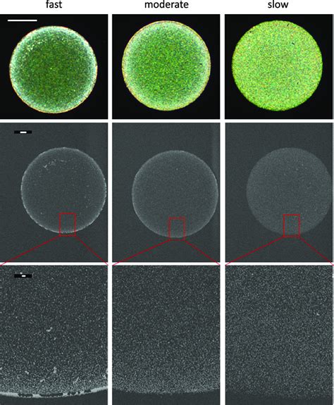 From top to bottom darkfield microscope image top scale bar 200 μm Download Scientific
