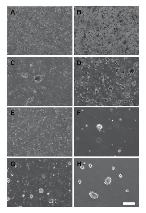 Isolating And Culturing Cells From Diffuse Intrinsic Pontine Glioma
