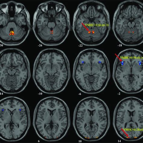 Support Vector Machine Svm Results A The Accuracy Of Download
