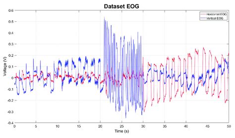 Graphical Representation Of Eog Data Set With Both Vertical And Download Scientific Diagram